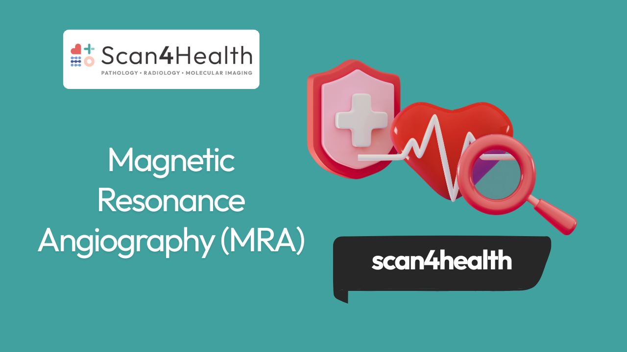 Magnetic Resonance Angiography (MRA) - Scan4Health Diagnostics Gurgaon ...