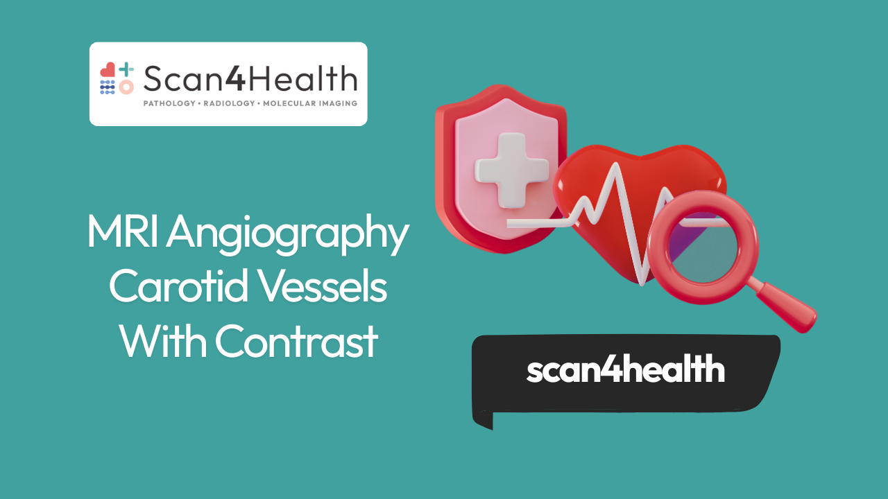 MRI Angiography Carotid Vessels With Contrast - Scan4Health Diagnostics Gurgaon - NABH Approved