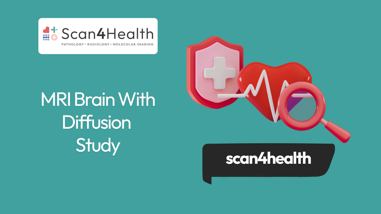 MRI Brain With Diffusion Study - Scan4Health Diagnostics Gurgaon - NABH Approved