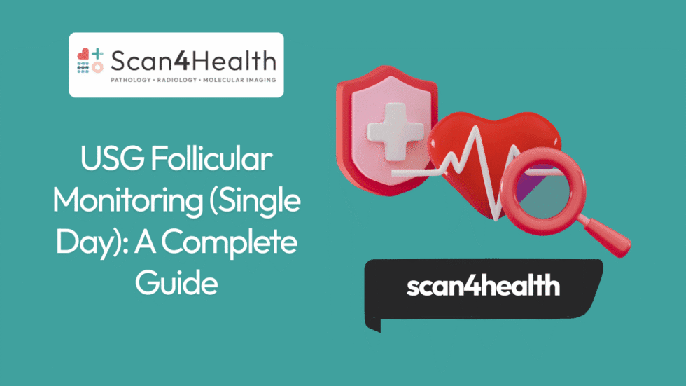 USG Follicular Monitoring (Single Day): A Complete Guide - Scan4Health ...